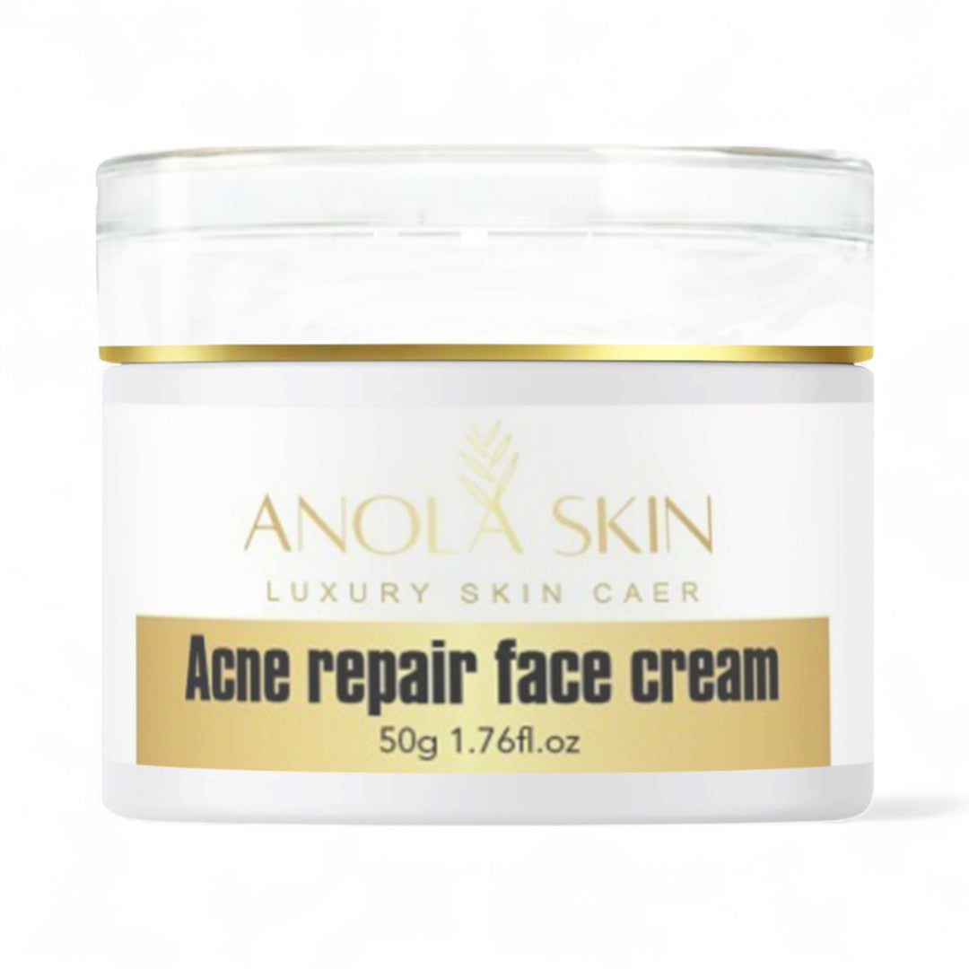 Acne Repair Face Cream – ANOLA SKIN