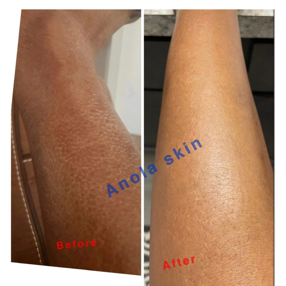 Tone Boosting Set – ANOLA SKIN